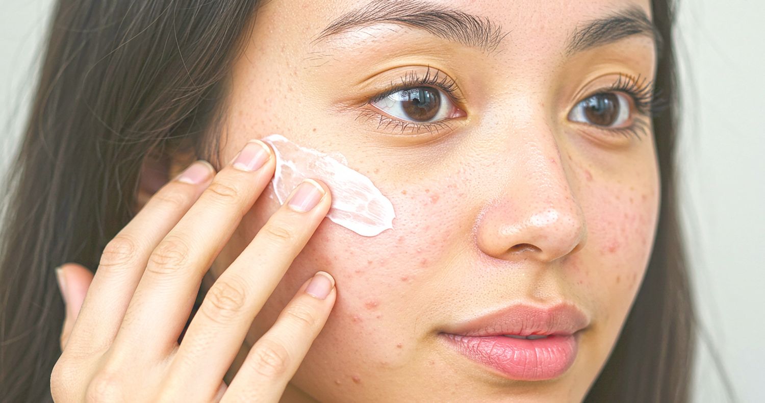 ¿Qué tipos de grano existen y cómo eliminarlos? – Real Cosmética